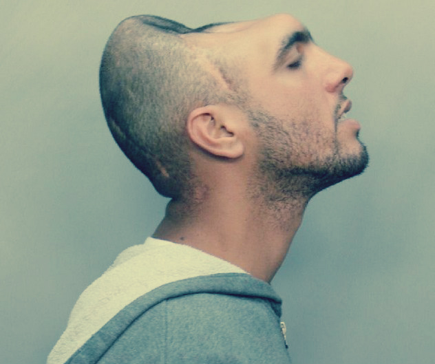 |شاهد| شاب يعيش بنصف رأس فقط: ليس عيبًا خلقيًا ولد به - المصري لايت